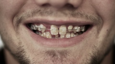 Angry Man Grinding Teeth Stock Footage Video (100% Royalty-free ...