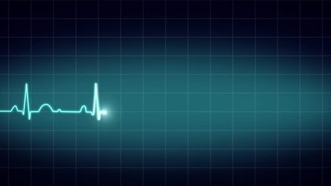 Animated Ekg Heartbeat Monitor Yellow Wave Stock Footage Video (100% ...
