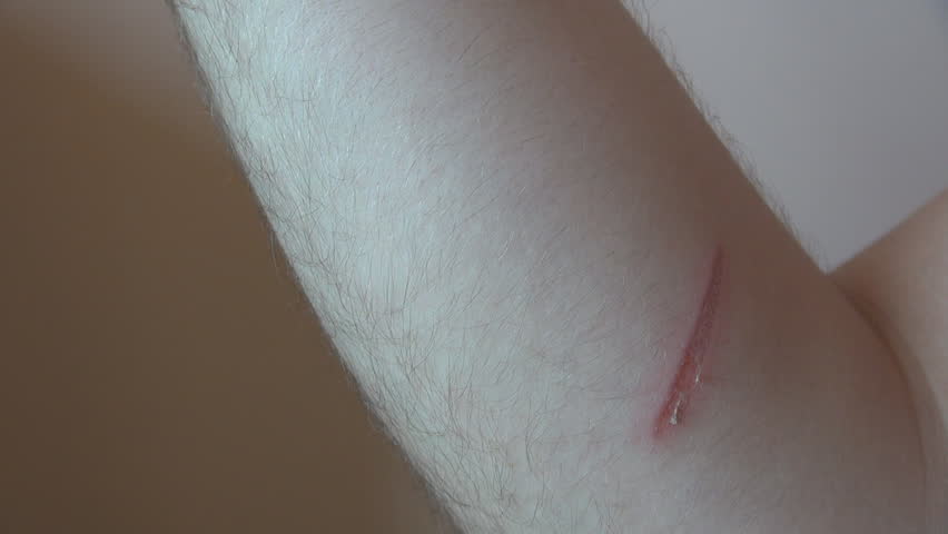 Man Hand Closeup Deep Cut Stock Footage Video (100% Royalty-free ...