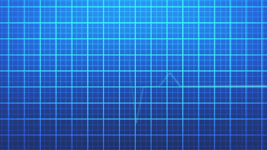 ekg monitor blue ecg shows healthy Arkivvideomateriale (100 % ...