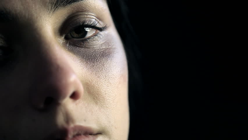 Woman with Bruises Crying After Stock Footage Video (100% Royalty-free ...