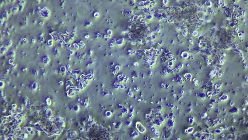 bacteria sample flesh decomposition 600x microscope Stock Footage Video ...