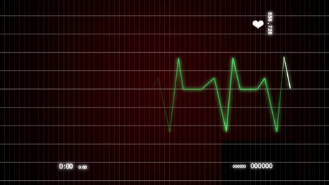 Flatline Blip On Medical Heart Monitor Stock Illustration 166545062 ...