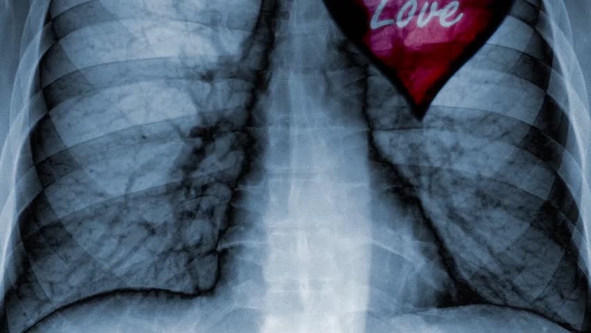 valentine's day romantic love heart x-ray Stock Footage Video (100% ...