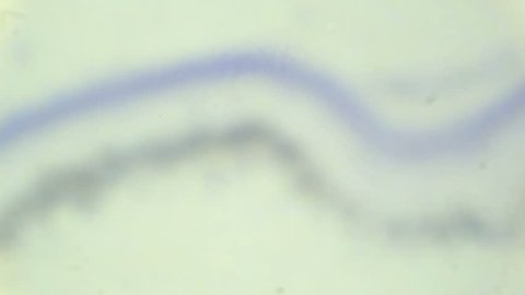 Penicillin Under Microscope Penicillium Wm Full Stock Footage Video ...