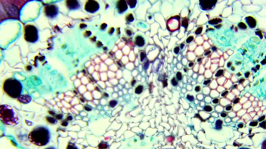 Pine Needle Cross-section Under the Stock Footage Video (100% Royalty ...