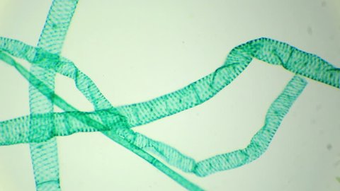 Conjugation Spirogyra Under Microscope Sexual Reproduction Stock ...