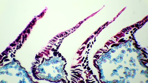 Longitudinal Section Male Pine Cones Under Stock Footage Video (100% ...