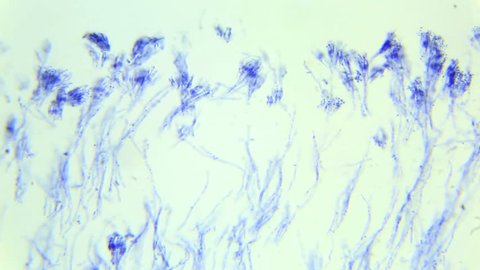 Penicillin Under Microscope Penicillium Wm Full Stockvideoklipp (helt ...