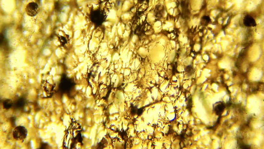 frog skin under microscope m full Stock Footage Video (100% Royalty ...