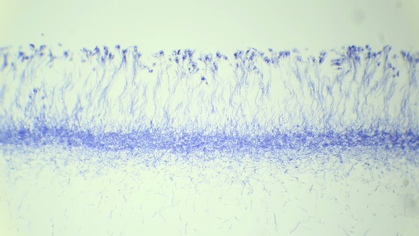 penicillin under microscope penicillium w full : vidéo de stock (100 % ...