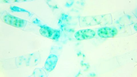 Conjugation Spirogyra Under Microscope Sexual Reproduction Stock ...
