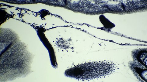 Slice Old Fetus Capsella Under Microscope Stock Footage Video (100% ...