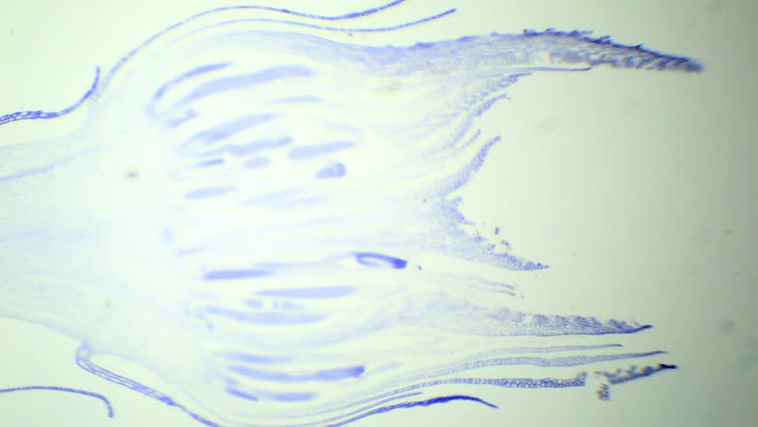 Antheridia Moss Under the Microscope Stock Footage Video (100% Royalty ...