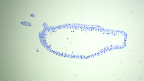 Longitudinal Section Hydra Under Microscope Hydra Stock Footage Video ...