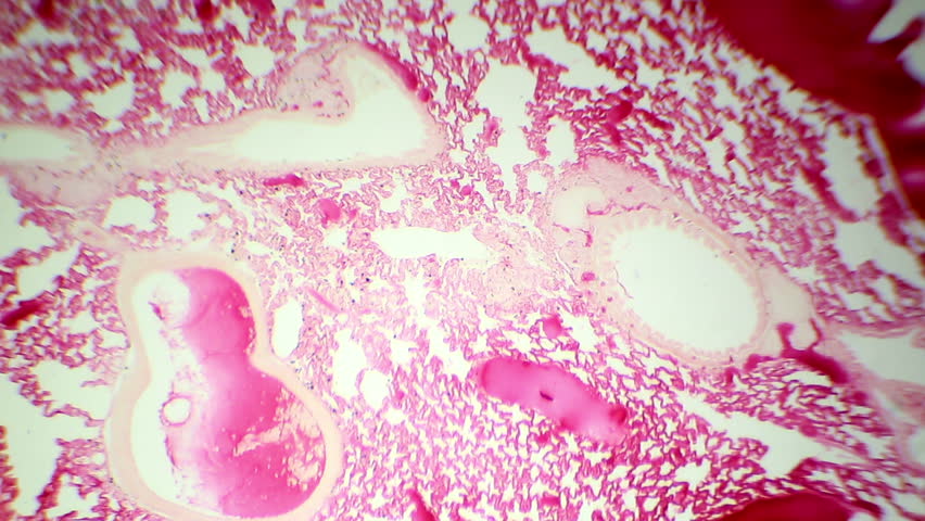 slice blood vessels rat under microscope 스톡 동영상 비디오(100% 로열티 프리 ...