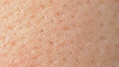 hydration process dark dull flaky skin Stock Footage Video (100% ...