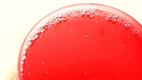 Colonies Cryptococcus Neoformans On Blood Agar Stock Photo 1174618177 ...